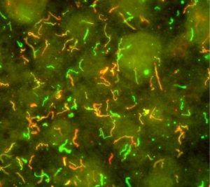 Decomposers In The Ocean? (Top 5 Examples Explained!) – Outlife Expert